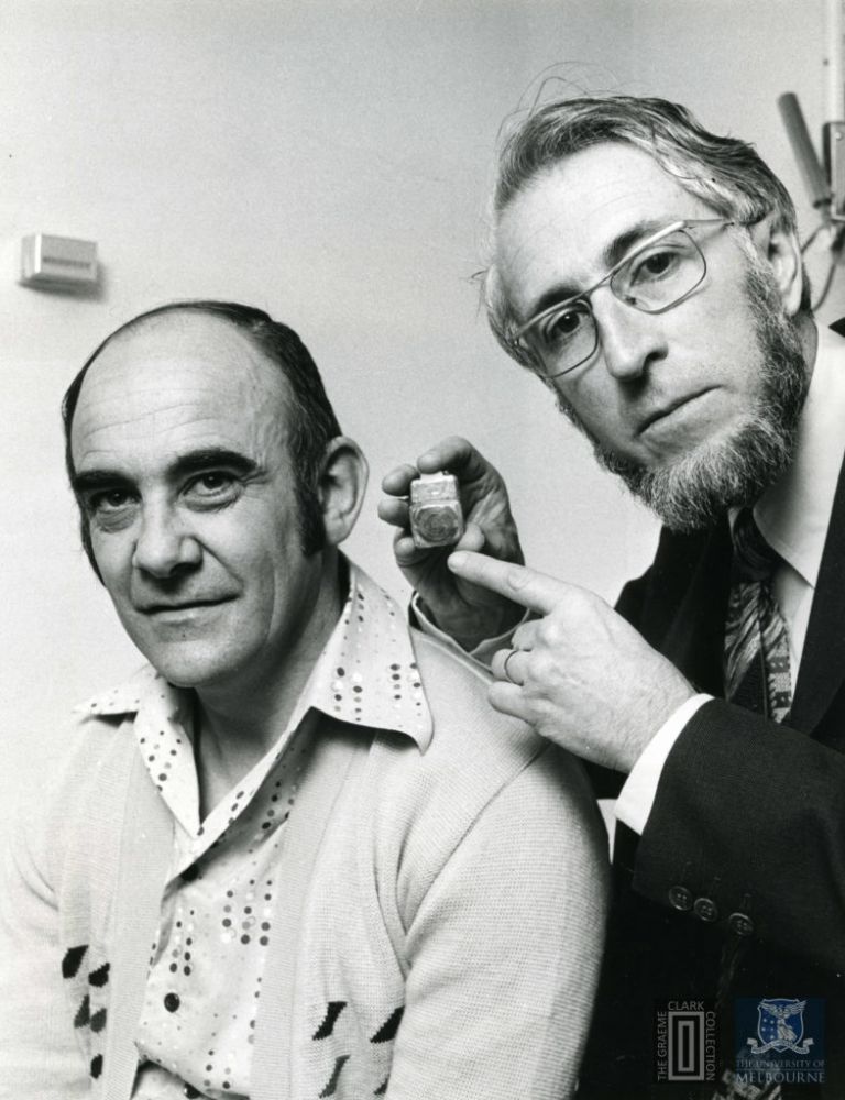 Il y a 45 ans, l’épopée de l’implant cochléaire